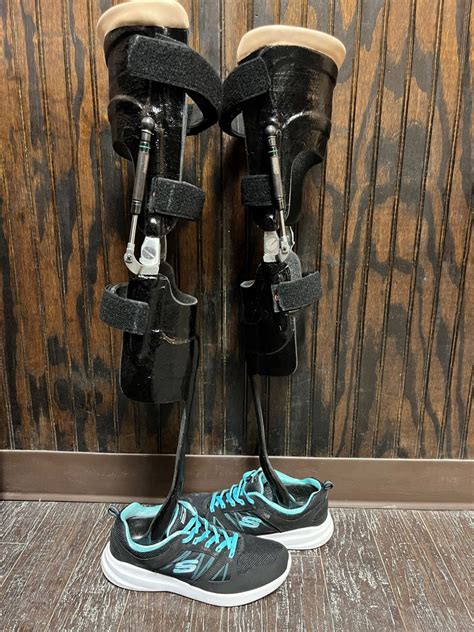 Southern Orthocare On Linkedin Bracing Cpo Orthopedics Custom
