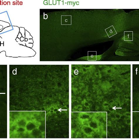 Immunofluorescence Of Mouse Brain After Intra Cerebroventricular