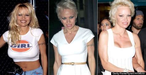 Pamela Anderson Finally Starts To Remove Barbed Wire Tattoo Pamela