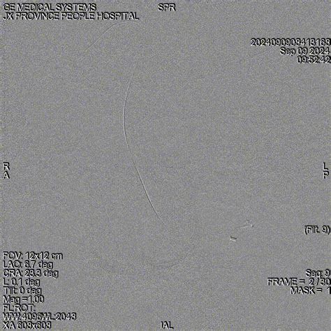 独创零先 循证而行丨江西省人民医院：fastunnel®输送型球囊扩张导管在基底动脉狭窄中的应用体会 脑医汇