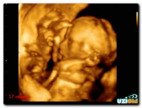 УЗИ 17 неделя беременности определение пола фото