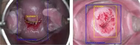 Development And Validation Of Artificial Intellige Ainave