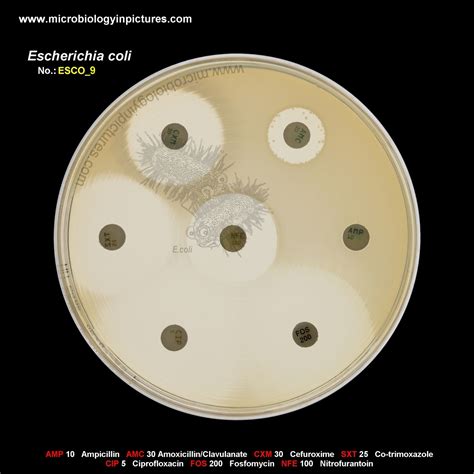 Escherichia Coli Resistant To Ampicillin And Amoxicillinclavulanate