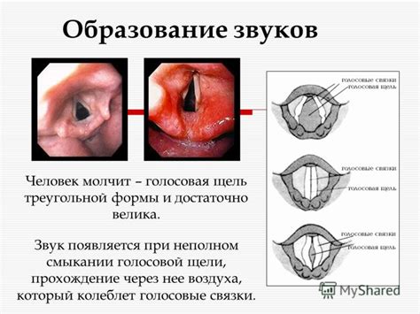 Презентация на тему Орган дыхательной системы гортань Строение