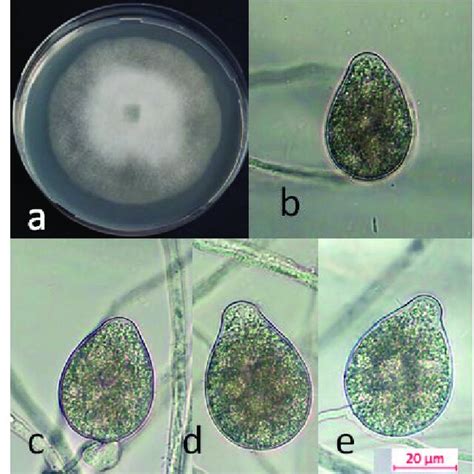 Morphology Of The Colonies And Asexual Structures Of P Download