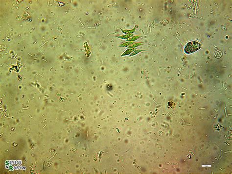 Synechococcus Galerie