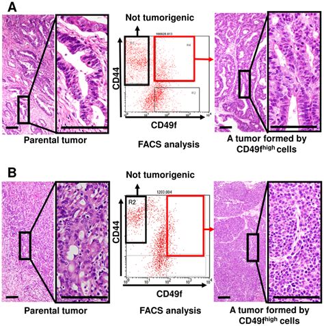 CD49fhigh cells form tumors while CD49flow cells do not. (A) A ...