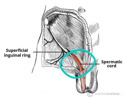 Spermatic Cord Pain Rvasectomy