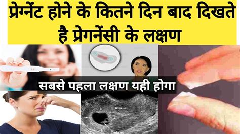Pregnant🤰 Hone Ke Kitne Din Baad Dikhte Hai Pregnancy Symptoms Sabse