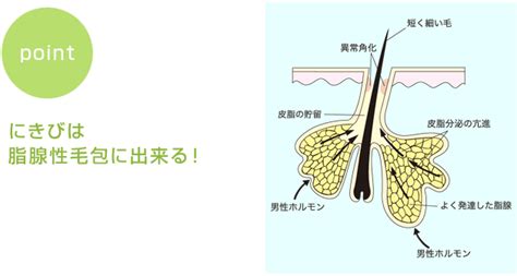 ニキビ治療｜大山皮膚科｜足立区 五反野駅1分の皮膚科