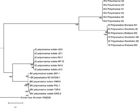Figure 2 From Presence Of The Newly Discovered Human Polyomaviruses Ki