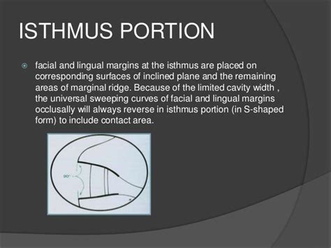 Modifications Of Class 2 Cavity Preparations