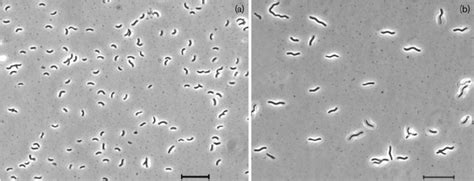 Phase Contrast Micrographs Of Moderately Halophilic Nitrate Reducing Download Scientific