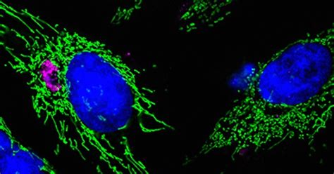 Chlamydiae Broaden Our Understanding Of The Evolution Of Intracellular