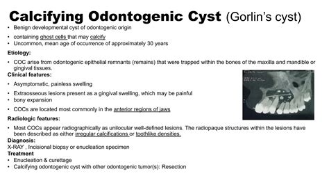 Classification And Management Odontogenic Cysts Of Oral Cavity Pptx