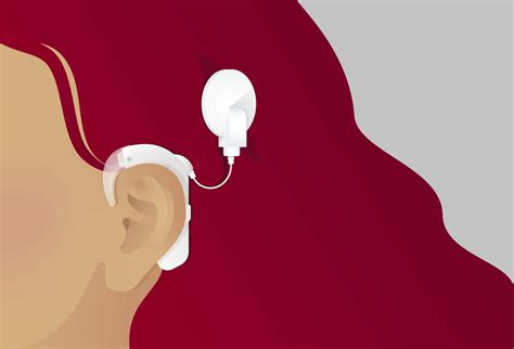 What Are The Differences Between Hearing Aids And Cochlear Implants