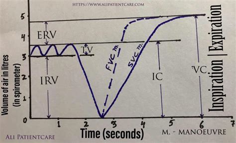 This A Graph Representing Volume Time Curve On Spirometry It Shows