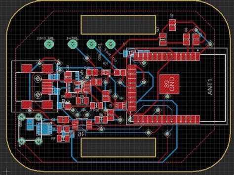 Wearable ESP With Medical Sensors And Battery Managment Freelancer