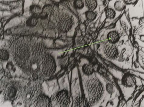 Chapter 15 Part 2 Flashcards Quizlet