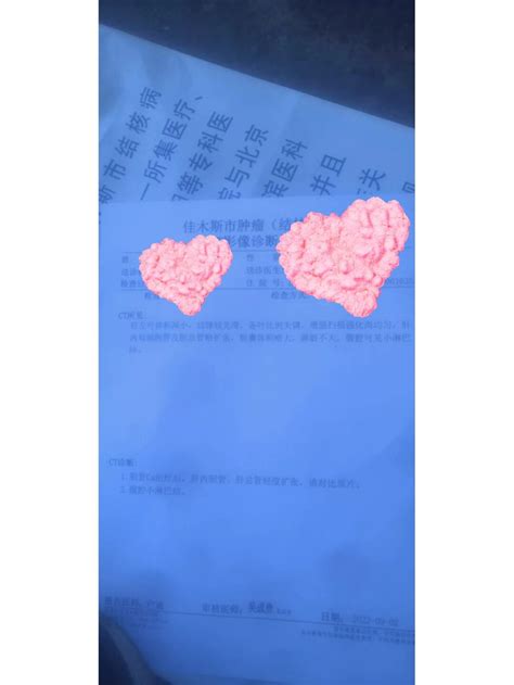 肝癌化疗期间吃什么最好肝癌第八次入院复查 哔哩哔哩