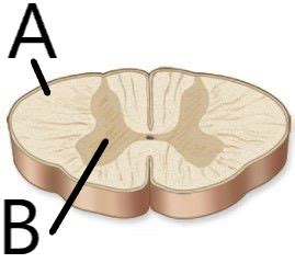 Chapter 13 Brain And Cranial Nerves Flashcards Quizlet