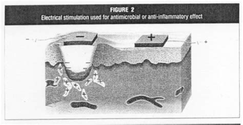 Electrical Stimulation Flashcards Quizlet