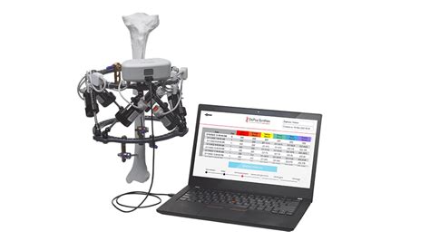 Maxframe Autostrut™ Multi Axial Correction System Depuy Synthes Jandj