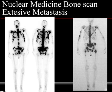 Nbme Sheld Flashcards Quizlet