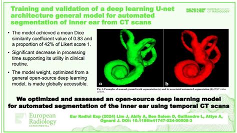 Douraied Ben Salem On Linkedin Ear Segmentation Ai Ct Latim