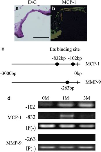 Downstream Of Ets 1 Transcription Factor In Experimentally Induced Ca