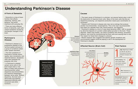 Lewy Body Dementia And Parkinsons Dementia Penn Memory Center
