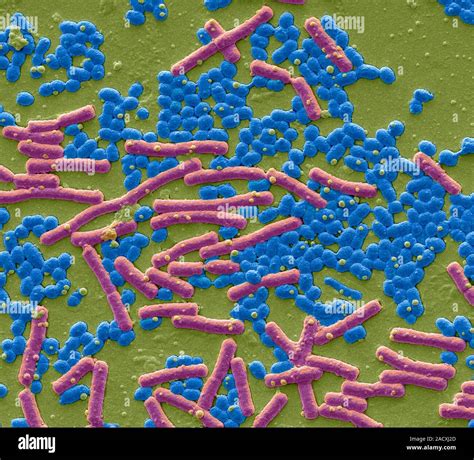 Haemolytic Streptococcus And E Coli Coloured Scanning Electron