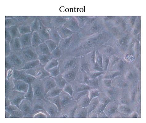 Phase Contrast Micrographs Showing A549 Cell Cultures A Untreated