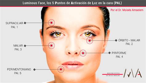 Anatomía Del Pómulo Aumento De Pómulos Con Ácido Hialurónico
