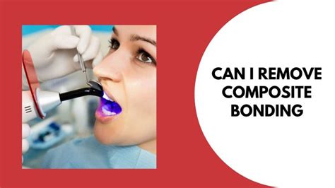 Can I Remove Composite Bonding Crowd Spirits