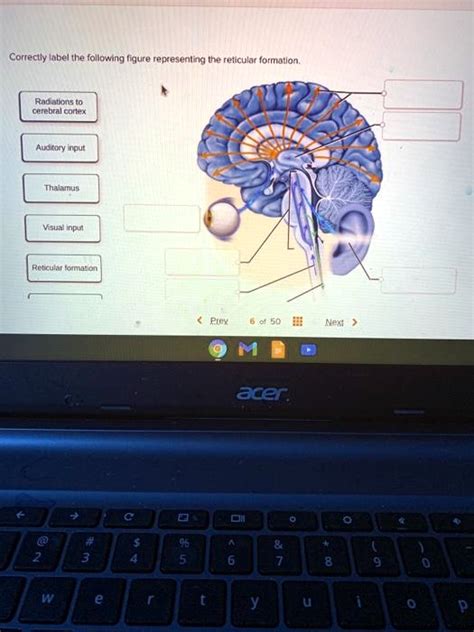 Solved Correctly Label The Following Figure Representing The Reticular