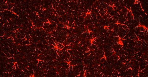 Immunofluorescent Stain Of Astrocytes Imgur