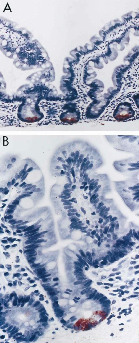 Immunoperoxidase Staining Of Formalin Fixed Normal Human Small Download Scientific Diagram
