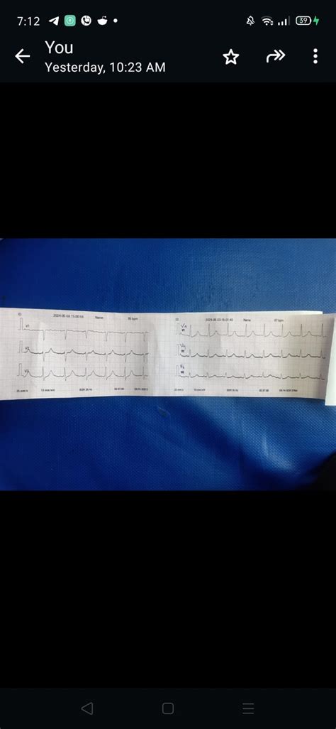 Is This St Segment Depression R Readmyecg