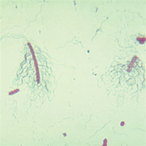 Proteus Gram Stain Proteus Gram Stain