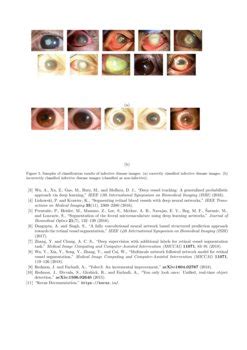 Automated Eye Disease Classification Method From Anterior Eye Image Using Anatomical Structure