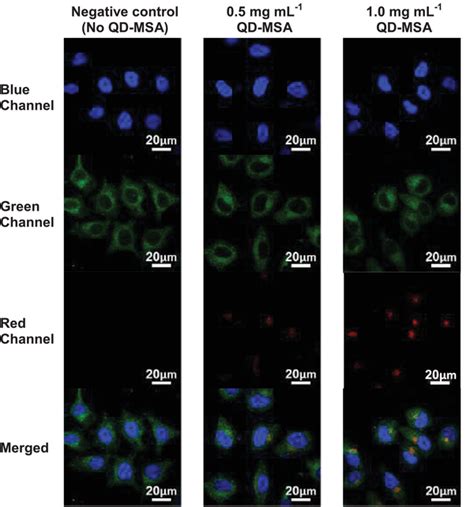 Fluorescence Confocal Microscopy Images Of HeLa Cells Incubated With