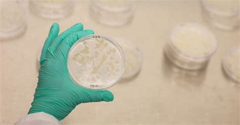 Biomedical Engineering Society On Linkedin Researchers At Uva Health Are Getting Closer To