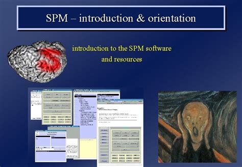 Spm Introduction Orientation Introduction To The Spm Software
