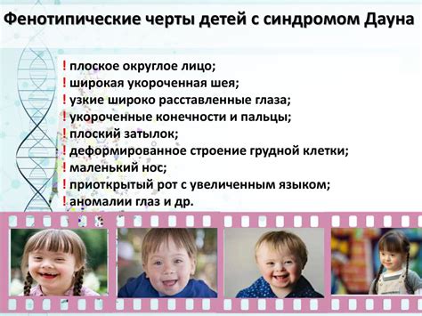 Формирование жизненных компетенций у детей с синдромом Дауна