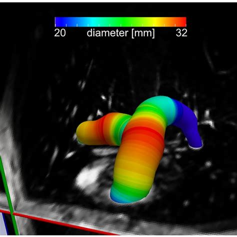 example of 3d segmentation result representative automated 3d