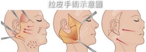 李晓东医生是哪个医院的是北京美媛荟医院的院长全天坐诊口唇对比照 8682整形网