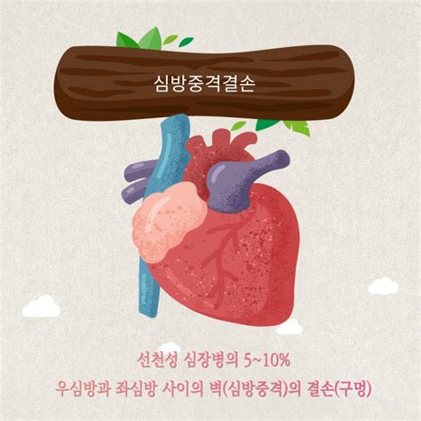 신생아 심장잡음 심장구멍 아기 심방중격결손 진단 받기까지 네이버 블로그