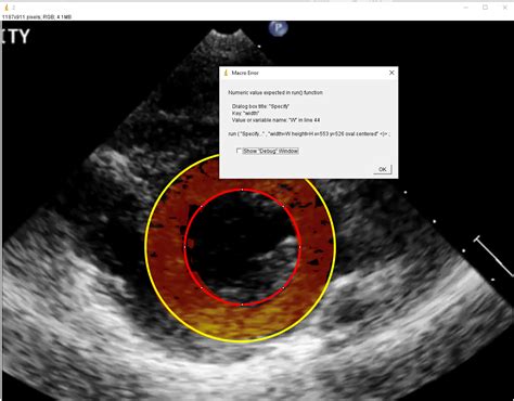 Background Subtraction Segmentation And Roi Calculation Image Analysis Image Sc Forum