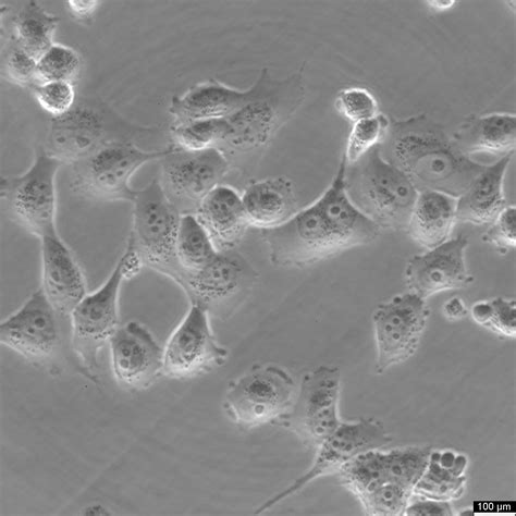 Nci H1299 Cells Carcinoma Cls